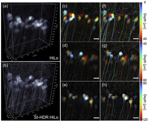 High-throughput high-dynamic range imaging by spatiotemporally ...