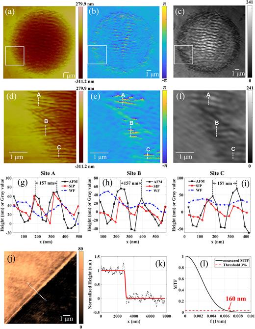 Super-resolution three-dimensional structured illumination profilometry for in situ measurement ...