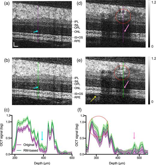 Spectral domain isolation of ballistic component in visible light OCT based on random matrix ...