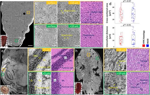 Label-free and non-destructive histology of unprocessed biological ...