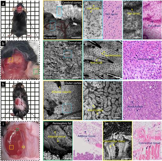 Label-free and non-destructive histology of unprocessed biological ...