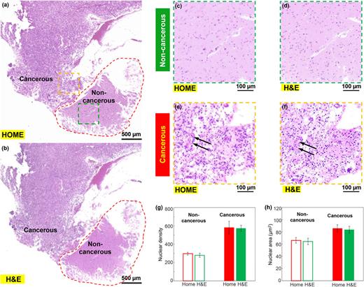 Multiplexing ultraviolet-excited ultrasound and autofluorescence ...