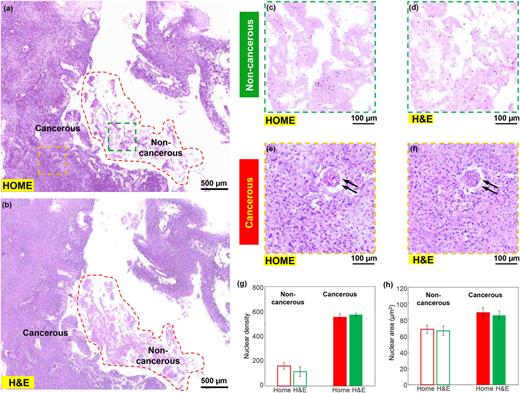 Multiplexing ultraviolet-excited ultrasound and autofluorescence ...