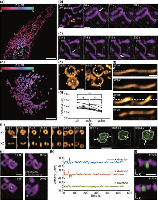 Fast axial resolution enhancement microscopy with structured ...