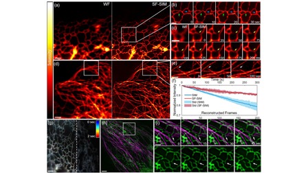 Single-frame structured illumination microscopy for fast live-cell ...