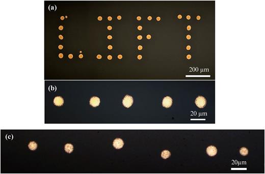 High-definition direct-print of metallic microdots with optical vortex ...