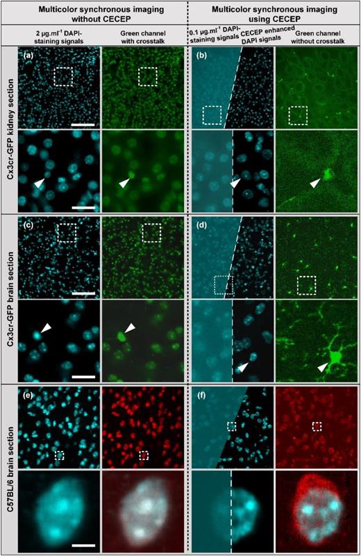 Unsupervised learning enables multicolor synchronous fluorescence ...
