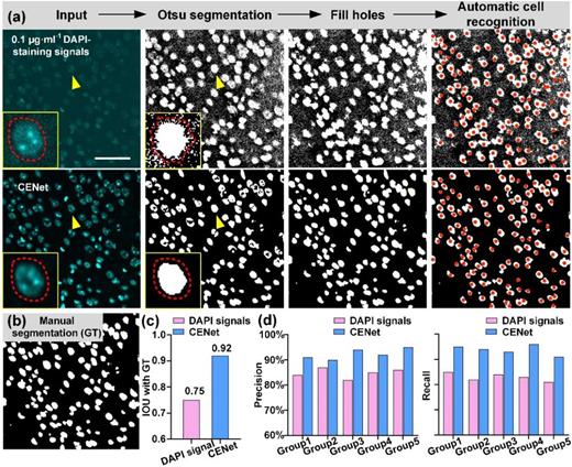 Unsupervised learning enables multicolor synchronous fluorescence microscopy without ...