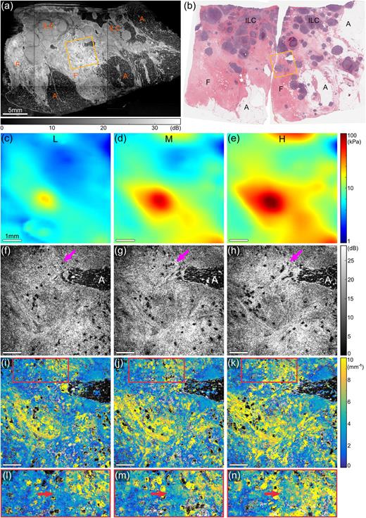 Load-dependent optical coherence tomography attenuation imaging: How ...