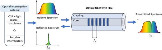 Embedding FBG sensors for monitoring vital signs of the human body ...