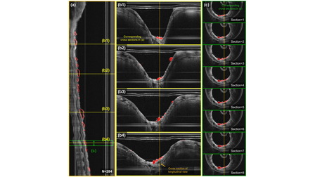 Quantitative assessment of chlorine gas inhalation injury based on ...