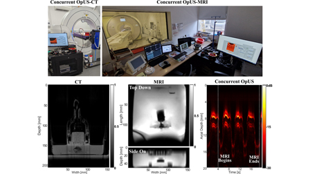 Multimodal optical ultrasound imaging: Real-time imaging under ...