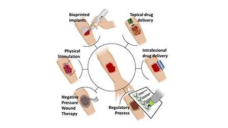 Engineering tools for stimulating wound healing | Applied Physics ...