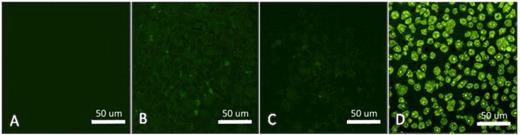 Physics considerations in targeted anticancer drug delivery by ...