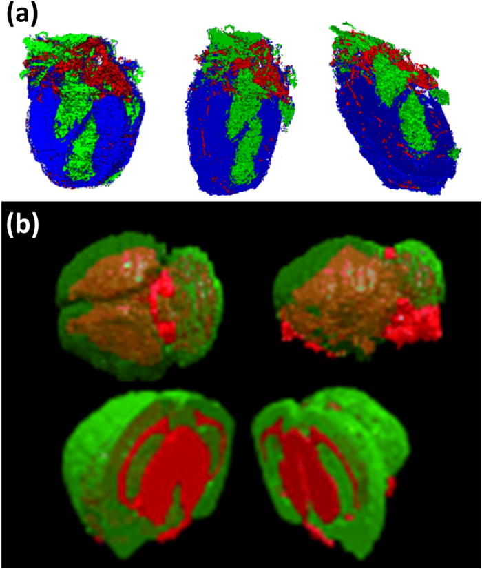 Latest applications of 3D ToF-SIMS bio-imaging | Biointerphases | AIP ...