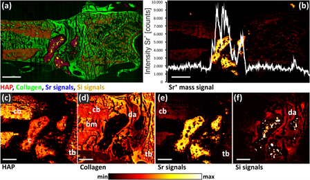 New insights into ToF-SIMS imaging in osteoporotic bone research ...