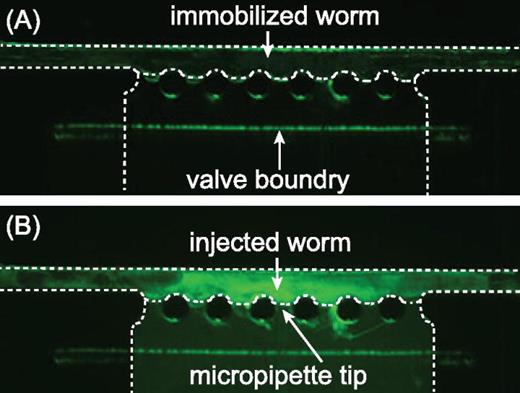 A microfluidic device for automated, high-speed microinjection of Caenorhabditis elegans ...