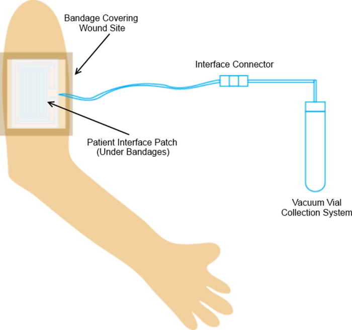 A fluid collection system for dermal wounds in clinical investigations ...