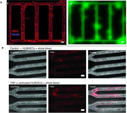 Endothelial cell culture in microfluidic devices for investigating ...