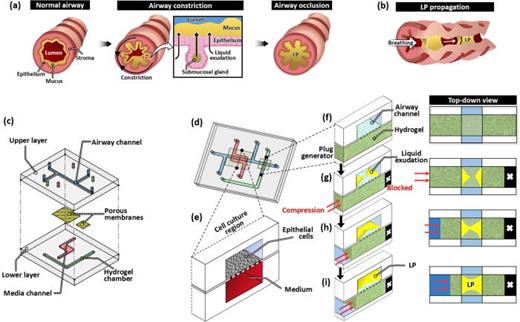 A bioinspired microfluidic model of liquid plug-induced mechanical ...