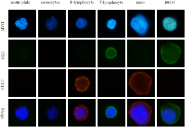 Two-way detection of image features and immunolabeling of lymphoma ...