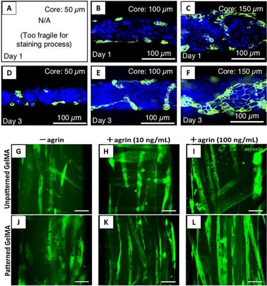 Microfluidic-assisted fiber production: Potentials, limitations, and ...