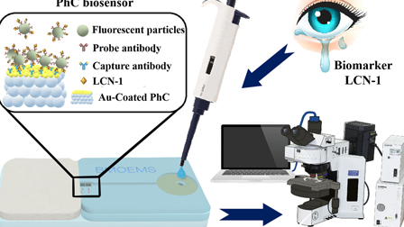 Photonic crystal enhanced immunofluorescence biosensor integrated with ...