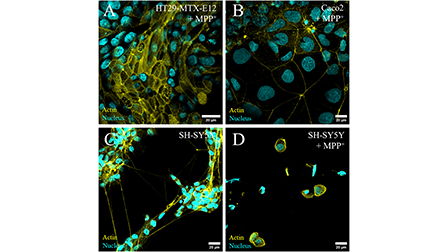 An in vitro multi-organ microphysiological system (MPS) to investigate ...