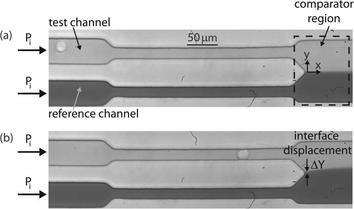 Probing the mechanical properties of brain cancer cells using a ...