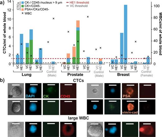 High efficiency vortex trapping of circulating tumor cells ...