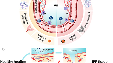 A roadmap for developing and engineering in vitro pulmonary fibrosis ...
