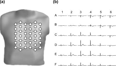 Cardiac magnetic field map topology quantified by Kullback-Leibler ...