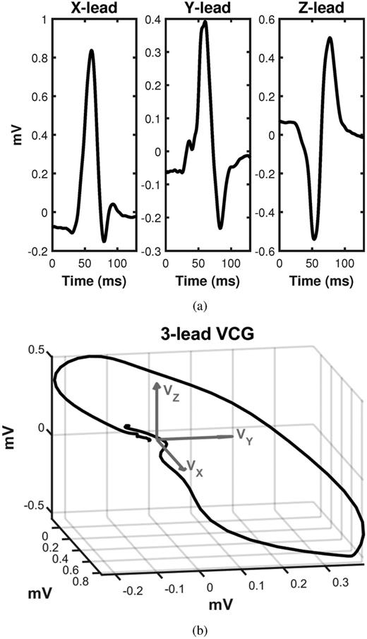 Cross Recurrence Analysis For Pattern Matching Of Multidimensional