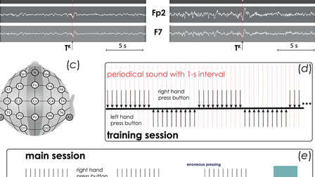 Analysis two types of K complexes on the human EEG based on classical ...