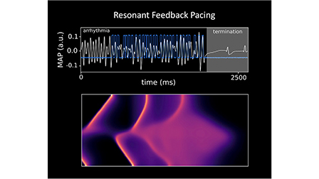 Efficient termination of cardiac arrhythmias using optogenetic resonant ...
