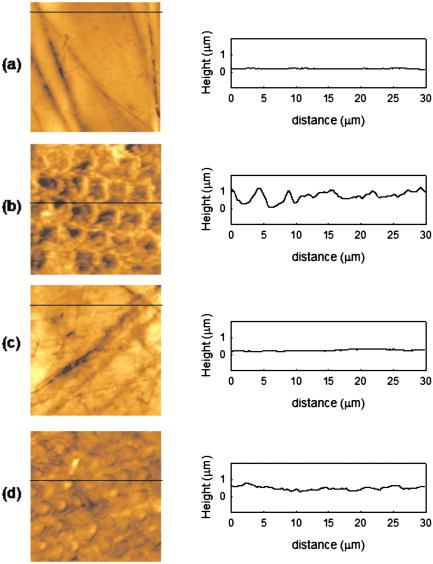 Surface kinetic roughening caused by dental erosion: An atomic force ...