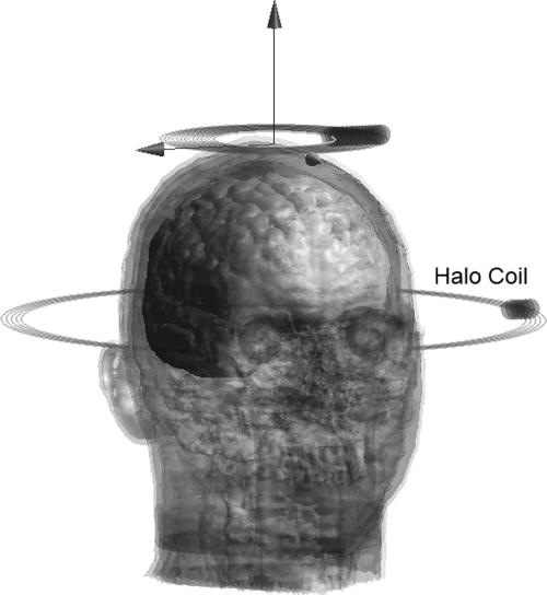 Transcranial magnetic stimulation: Improved coil design for deep brain ...