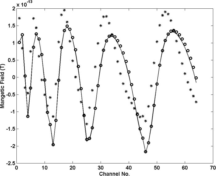 Signal Space Separation Method With Block Matrix Inversion For Extraction Of Signals In