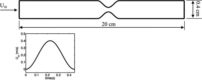 Alteration of chaotic advection in blood flow around partial blockage ...