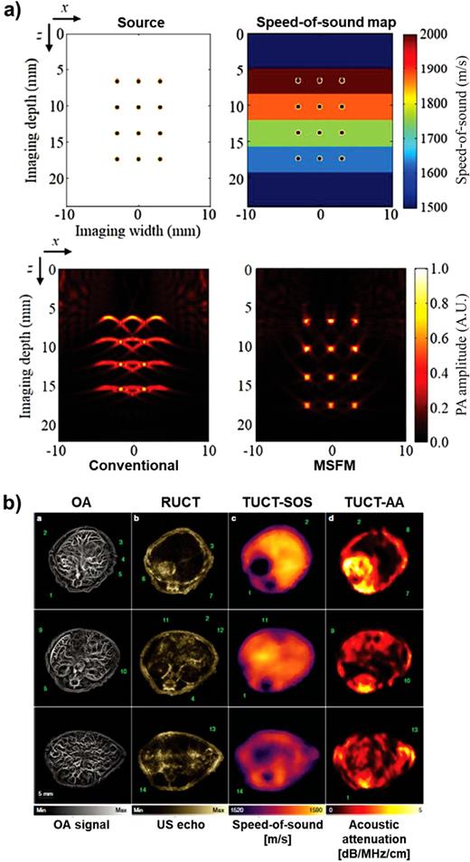 Practical photoacoustic tomography: Realistic limitations and technical ...