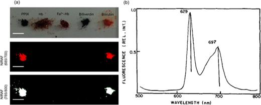 The role of tissue fluorescence in in vivo optical bioimaging | Journal ...
