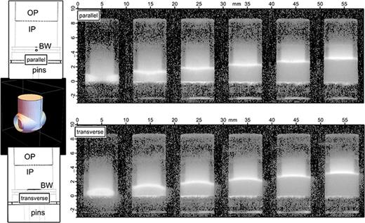Experimental observations of exploding bridgewire detonator function ...