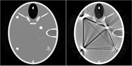 Fused x-ray and fast neutron CT reconstruction for imaging large and dense objects | Journal of ...