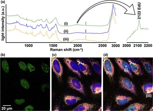 Slit-scanning Raman microscopy: Instrumentation and applications for ...