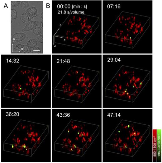 Slit-scanning Raman microscopy: Instrumentation and applications for ...