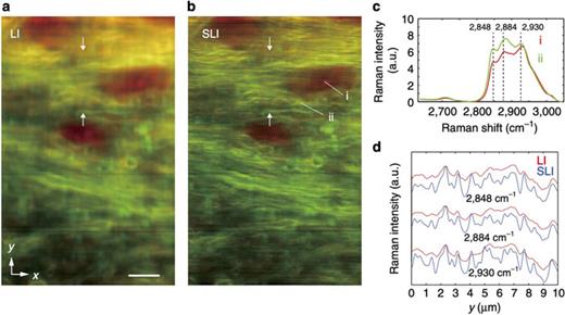 Slit-scanning Raman microscopy: Instrumentation and applications for ...