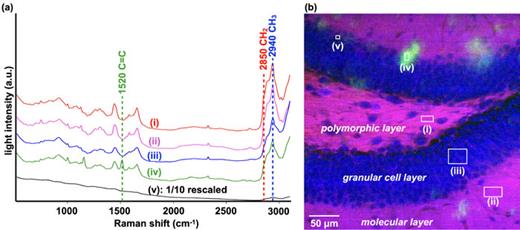 Slit-scanning Raman microscopy: Instrumentation and applications for ...