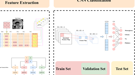 An improved hybrid quantum-classical convolutional neural network for multi-class brain tumor ...