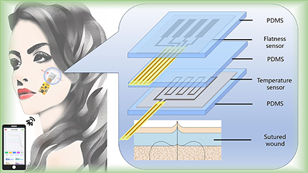 A fully integrated flexible wireless sensing system for wound flatness ...
