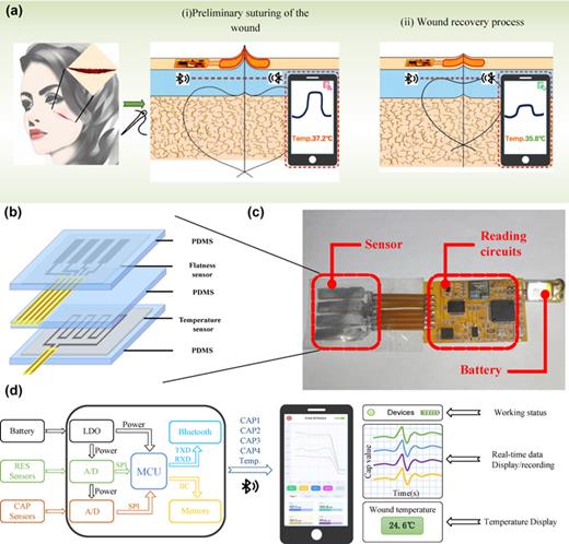 A fully integrated flexible wireless sensing system for wound flatness ...
